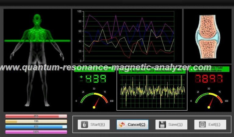 Whant Is Quantum Body Scan? - MAIKONG Quantum Resonance Magnetic Analyzer